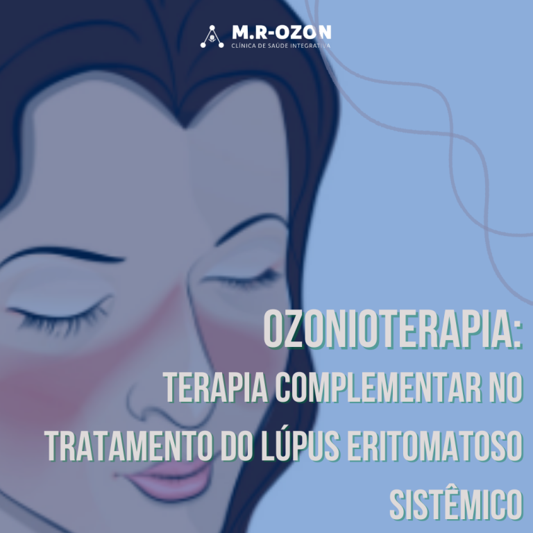 Ozonioterapia como terapia complementar no tratamento do lúpus eritematoso sistêmico. – M.R-OZON